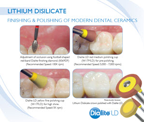 Dialite® LD (Lithium Disilicate) Polishing Tips - Brasseler CAD/CAM ...